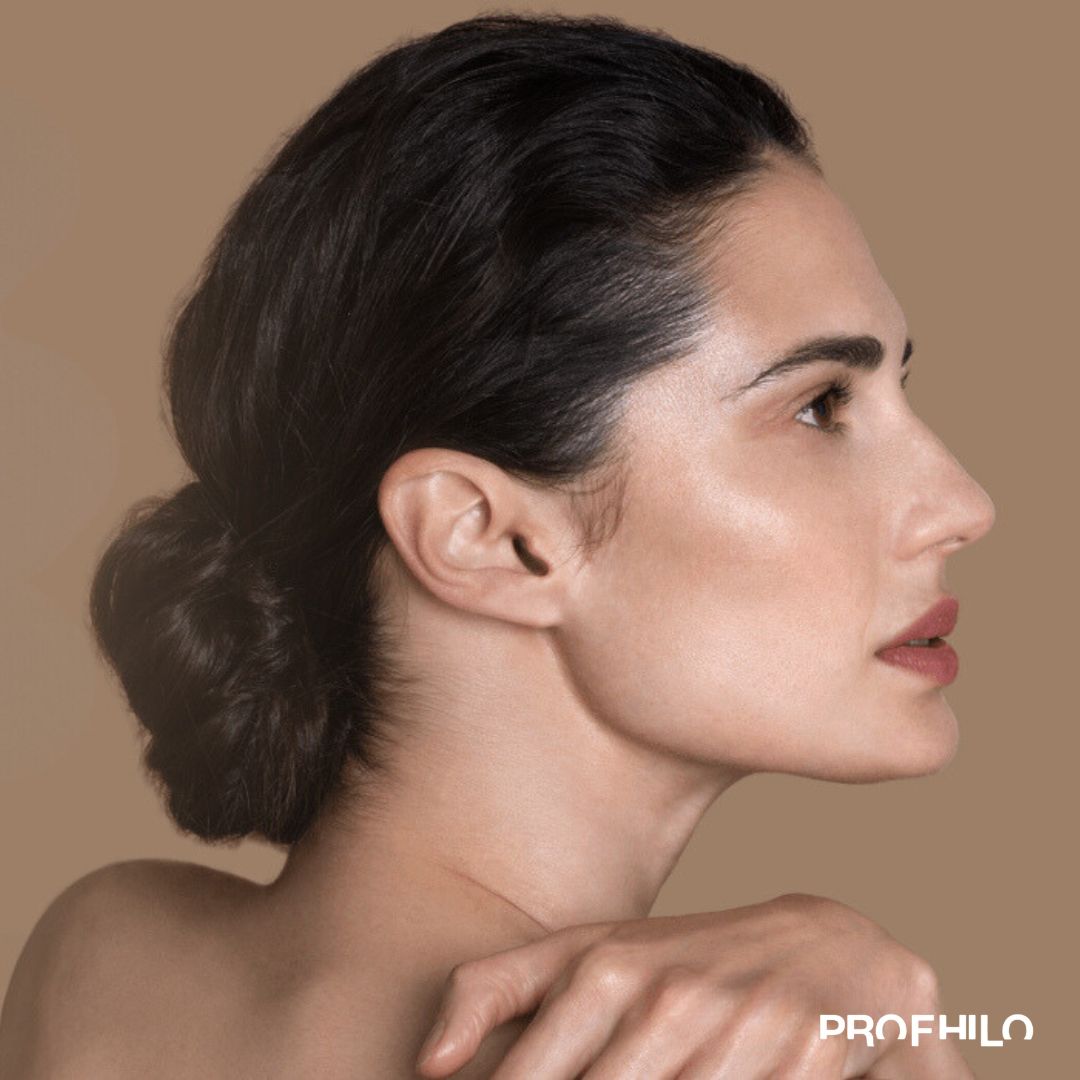 Profhilo | Buy Profhilo | ACRE Pharmacy