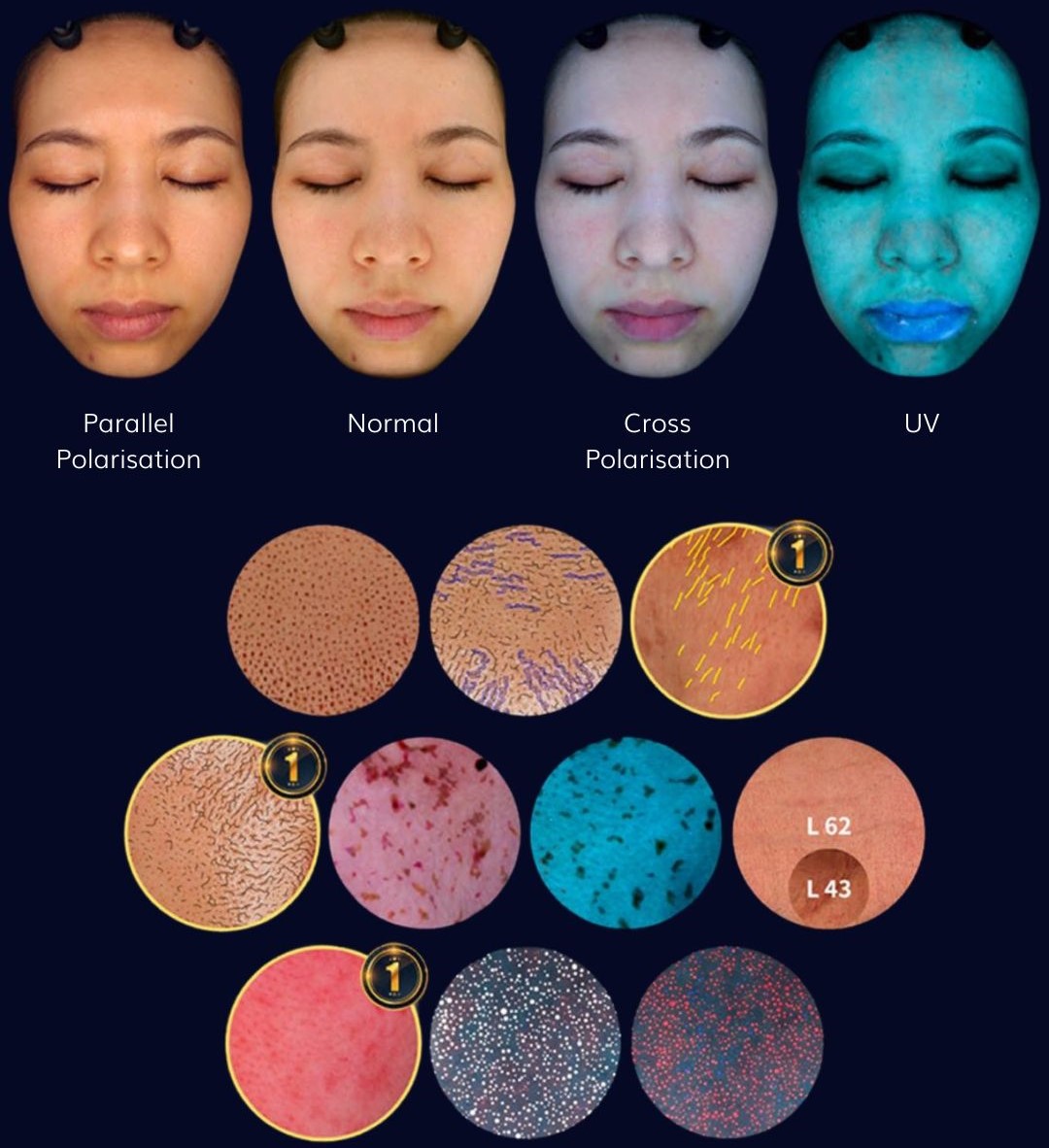 Focuskin Skin Analysis System | ACRE Pharmacy