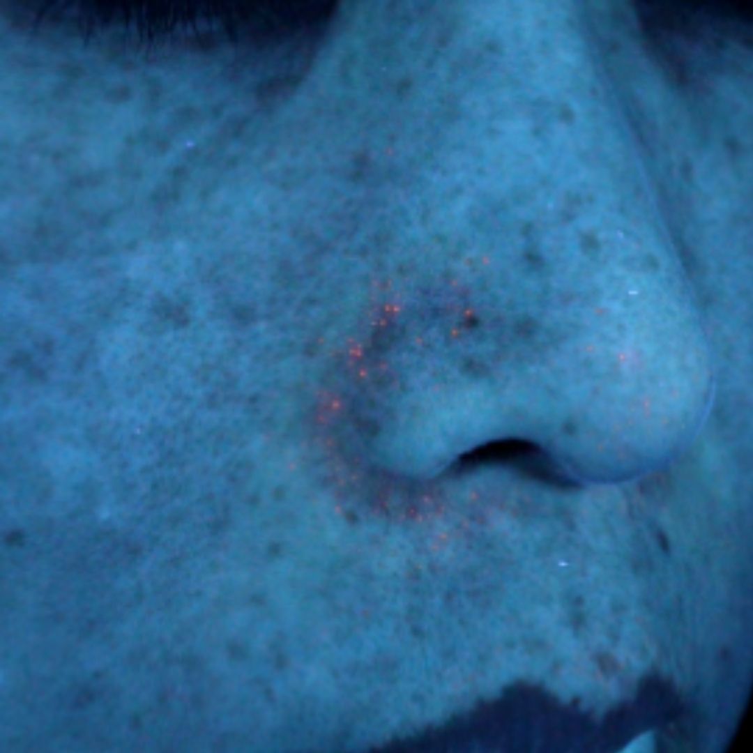 JANUS Pro Device | ACRE Pharmacy