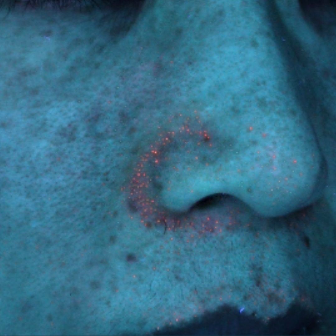 JANUS Pro Device | ACRE Pharmacy