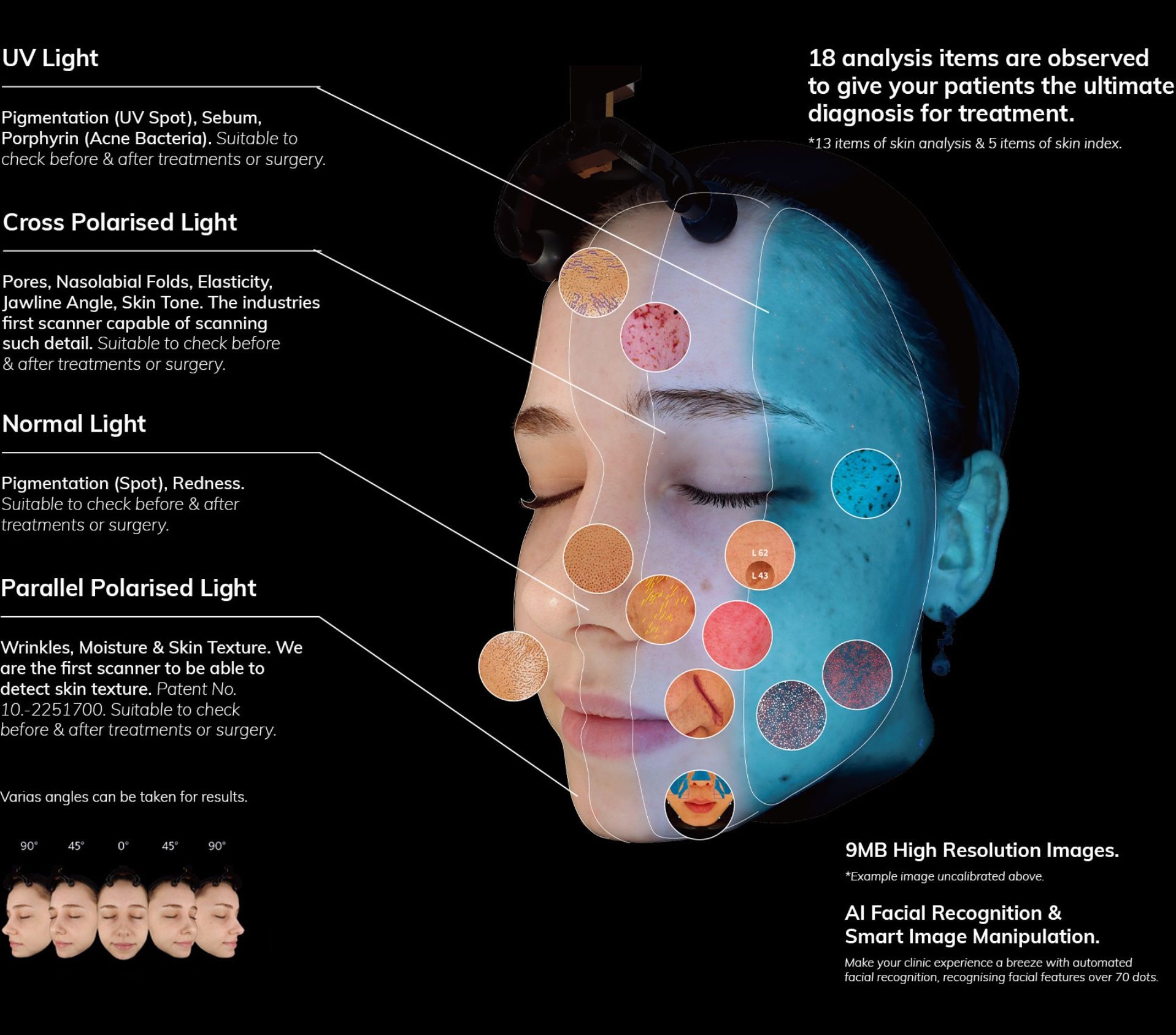 JANUS Pro Device | ACRE Pharmacy