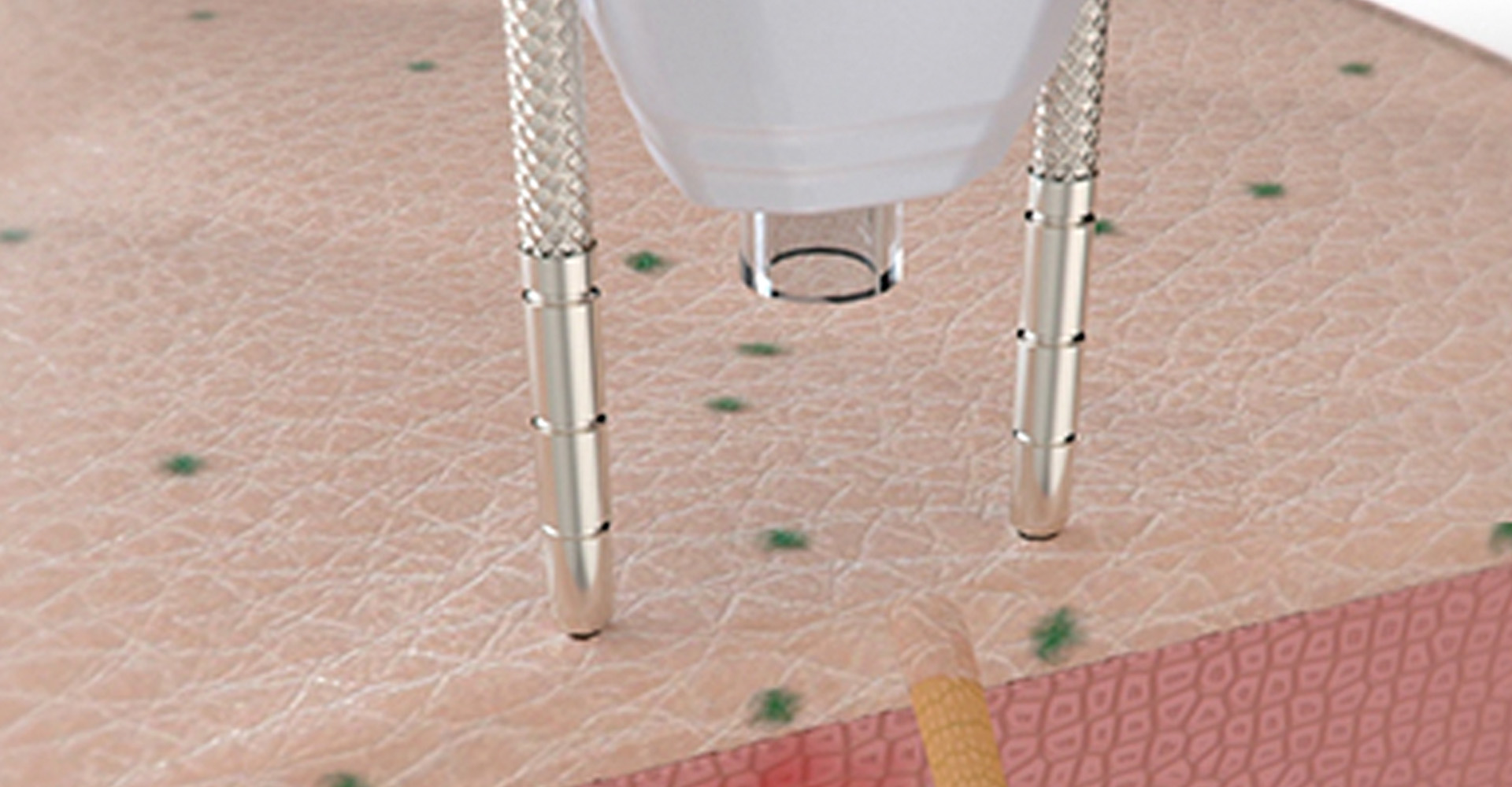 PlaDuo Dual Plasma System | ACRE Pharmacy