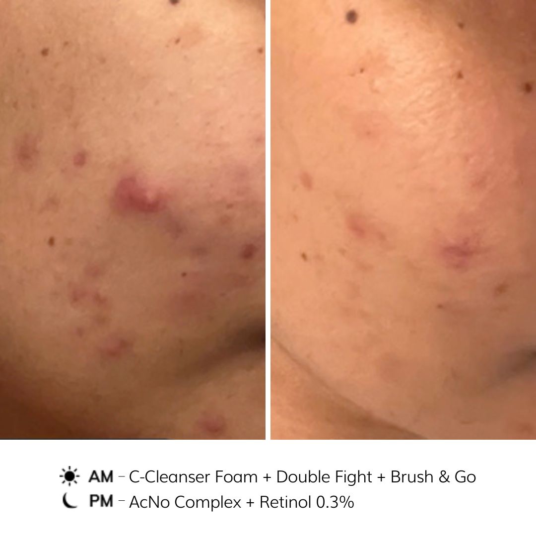 Product: Noon C-Cleanser Foam 200ml