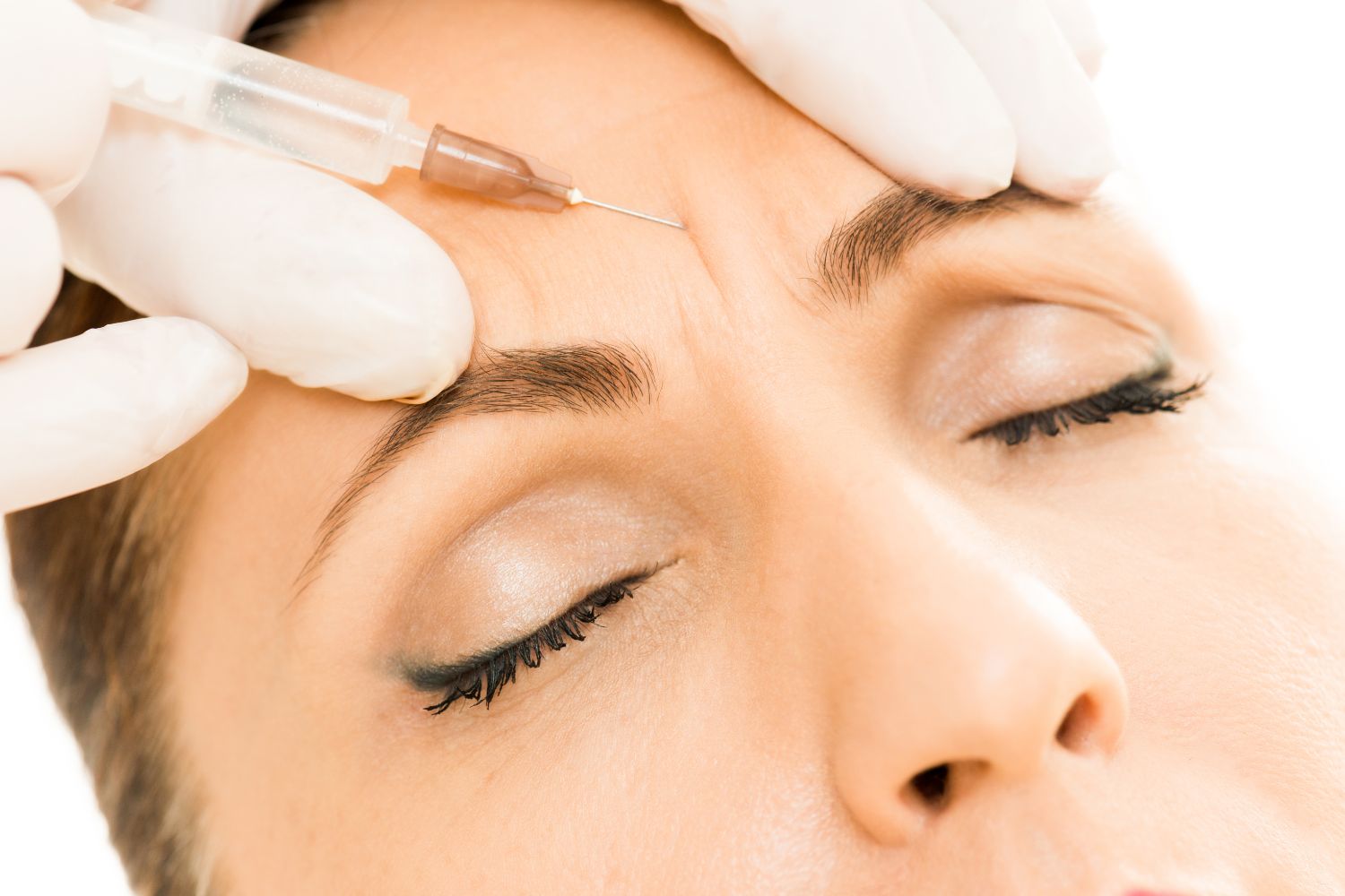 Alluzience vs. Botox | Blog | ACRE Pharmacy